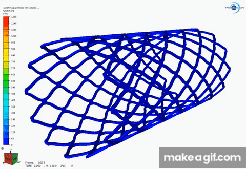 Simulation of a stent compression/expansion - FORGE® on Make a GIF