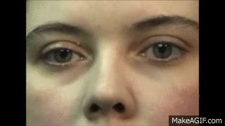 pendular nystagmus on Make a GIF