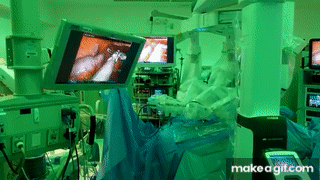 How robot assisted surgery works (as explained by a surgeon) on Make a GIF