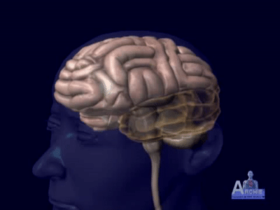 Parkinsons Disease and Dopamine on Make a GIF