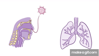 Respiratory Syncytial Virus and Bronchiolitis causes, symptoms ...