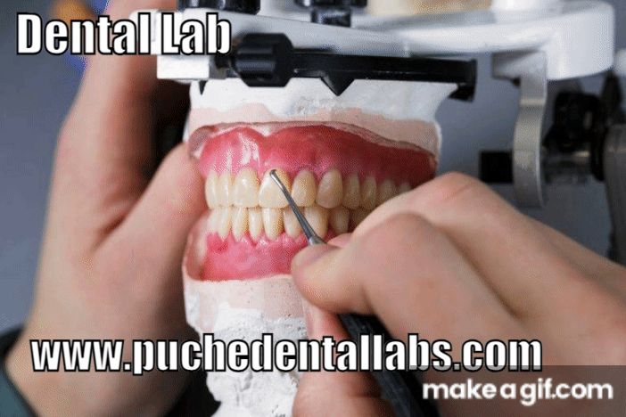 Puche Dental Lab Exploring Innovations in Dental Restorations on Make a GIF Puche Dental Lab Exploring Innovations in Dental Restorations on Make a GIF
