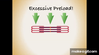 Cardiac Preload & Frank-Starling Law (simply explained) . on Make a GIF