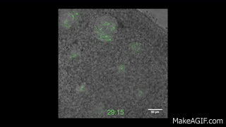 A new set up for organoid and tissue imaging on Make a GIF