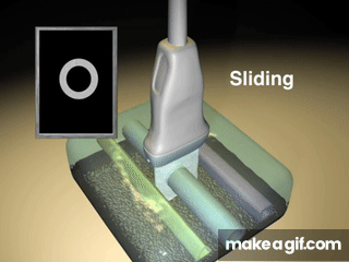 Ultrasound Transducer Manipulation on Make a GIF