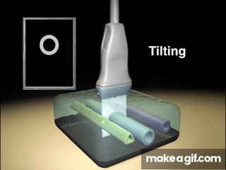 Ultrasound Transducer Manipulation on Make a GIF