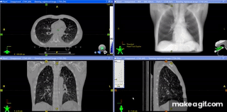 Aquilion LB 4D CT on Make a GIF