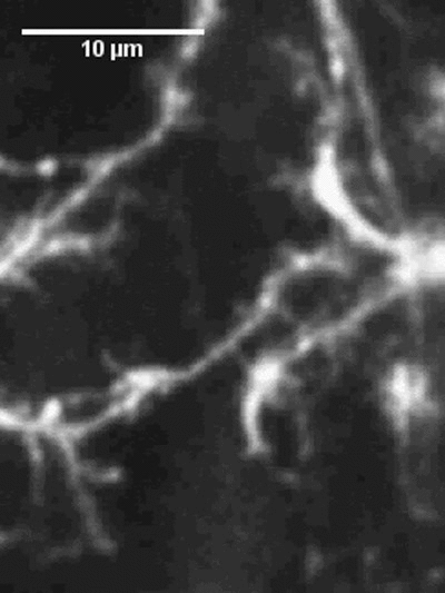 Motility of Cortical Astrocytes recorded every minute for 13 minutes on ...