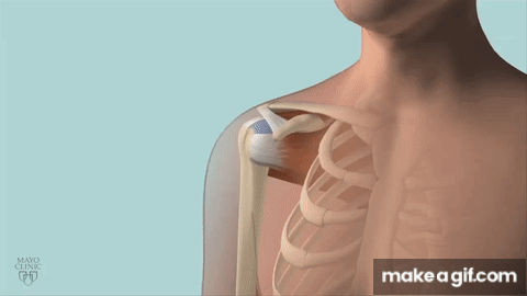 Learn About Rotator Cuff Damage on Make a GIF