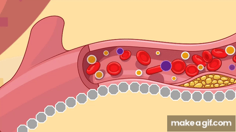 Diabetes tipo 2 - Explicada Fácilmente Para Pacientes on Make a GIF
