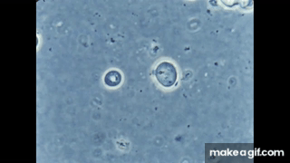 57. Budding of Yeast Cells on Make a GIF