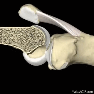 Patellofemoral joint motion and patellar tracking on Make a GIF