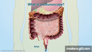 What happens during and after a colonoscopy? on Make a GIF