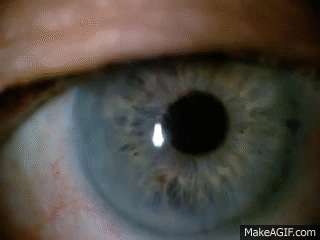 Iridodonesis FS28RE.wmv on Make a GIF