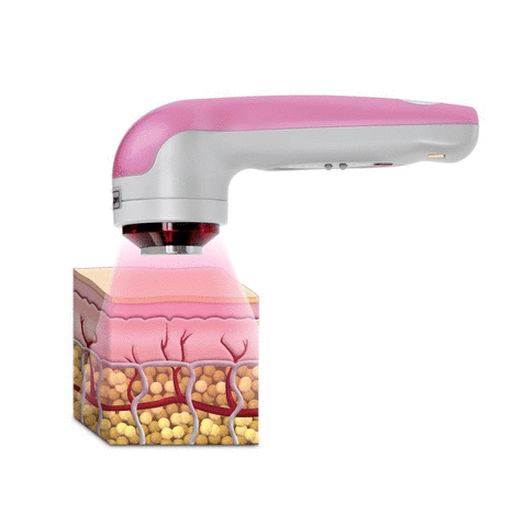 Skin Cure ultrasound device - mode 5 - Skin Rejuvenation Sensitive Skin ...