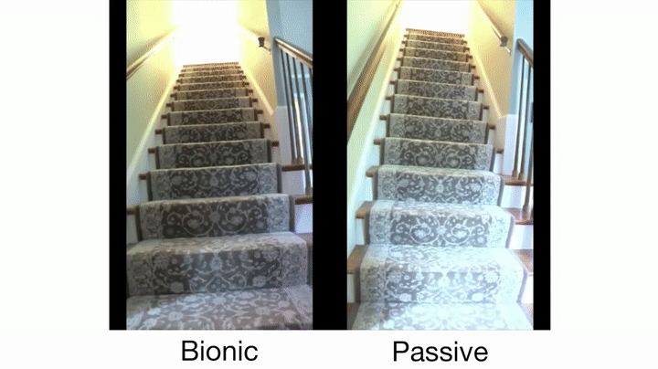 Bionic vs Passive prosthesis on Make a GIF