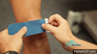 Taping - Patellofemoral Pain Syndrome on Make a GIF