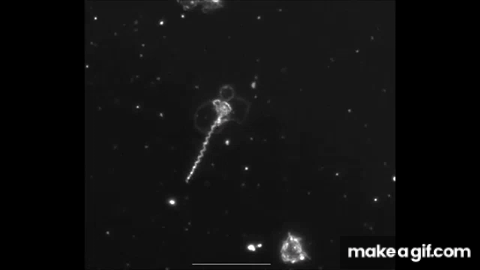 Interaction of Treponema pallidum, the syphilis spirochete, with human ...