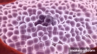 3D Medical Animation - What is Cancer? on Make a GIF