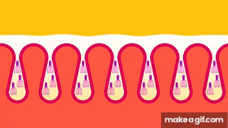 Helicobacter pylori (H. pylori) & Peptic Ulcer Disease on Make a GIF