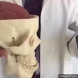 what happens to the brain during a concussion on Make a GIF