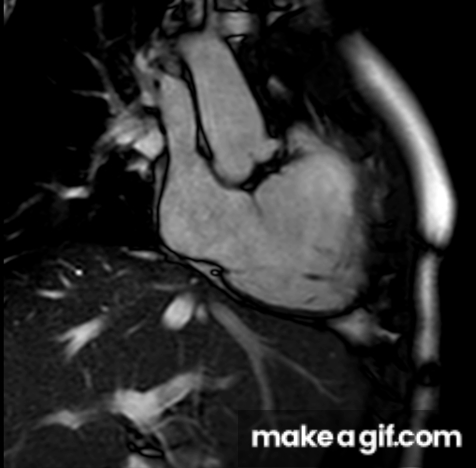 ZMHgw5 is an Animated GIF Image on Make a GIF