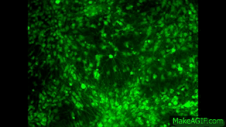 Neuronal synchronized firing - Calcium oscillation in neurons on Make a GIF