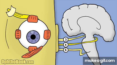 Cranial Nerve Palsies (ophthalmology lecture) on Make a GIF