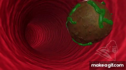 High Cholesterol Medical Animation (Hyperlipidemia) on Make a GIF