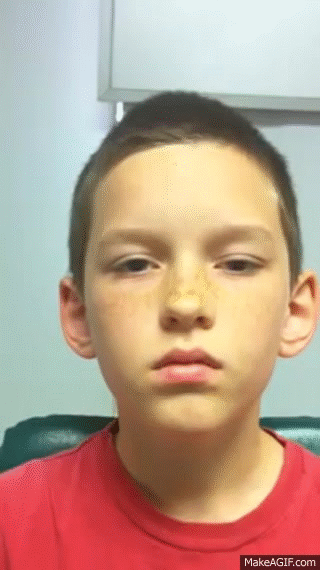 Marcus Gunn jaw-winking syndrome on Make a GIF