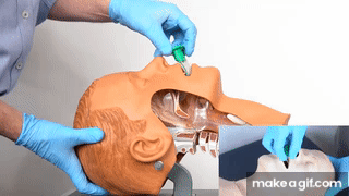 Oropharyngeal Airway Insertion | Guedel | OPA | ABCDE Emergency | OSCE ...