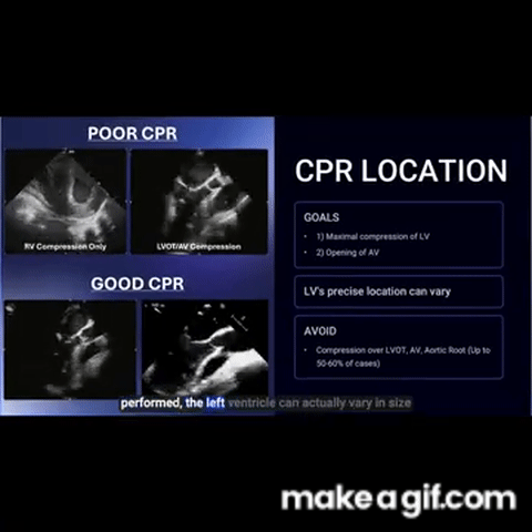quality of cpr on Make a GIF