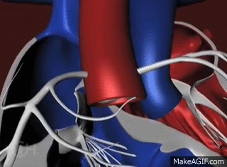 The Arterial Switch Operation to Treat Transposition of the Great ...