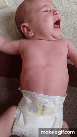 Chest Retractions Associated With Laryngomalacia on Make a GIF