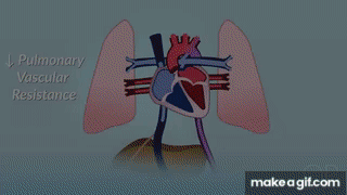 "Respiratory Distress in the Newborn" by Megan Connelly for ...