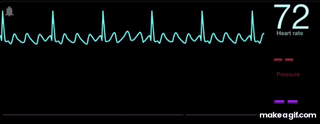 13 Flutter auricular on Make a GIF
