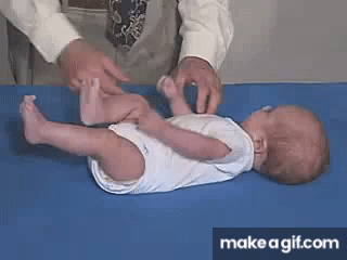Neurology Exam, 3 Month: Reflexes-Deep Tendon Reflex on Make a GIF