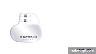 How pacemakers work (Medical Animation) on Make a GIF