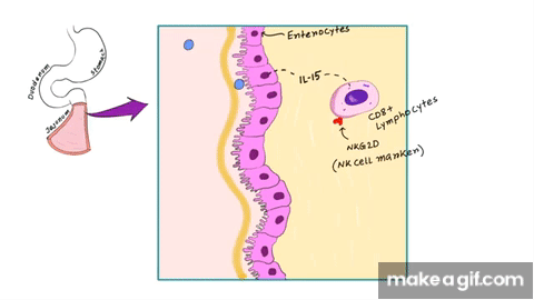 Celiac Disease Pathophysiology Simplified on Make a GIF