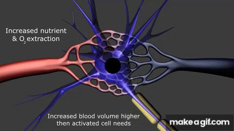 fMRI (Functional MRI) on Make a GIF