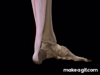 Achilles Tendon Rupture | Complete Anatomy on Make a GIF