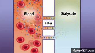 Hemodialysis and how it works - IKAN ch6 on Make a GIF