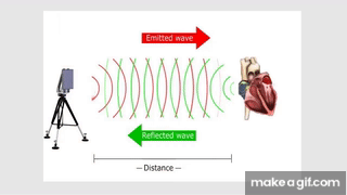 Robust mm-Wave Radar Based Heart and Breathing Rate Monitoring on Make ...