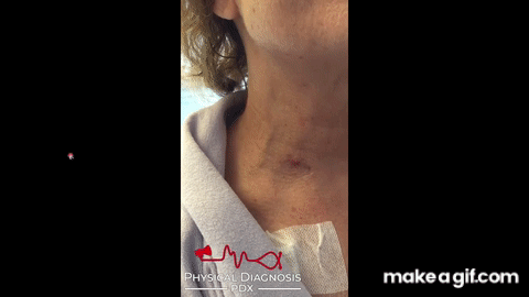 Jugular Venous Pulse: Qualitative Assessment on Make a GIF