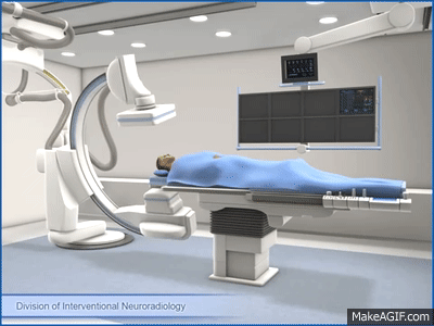 Diagnostic Cerebral Angiography on Make a GIF