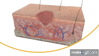 Wound Healing on Make a GIF
