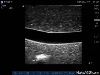 An example refraction with ultrasound on Make a GIF