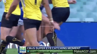 What causes patella dislocation? on Make a GIF