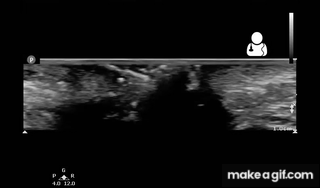 uotw22.2 on Make a GIF