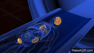 PET Scan animation on Make a GIF
